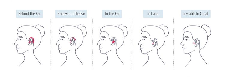 Types of Hearing Aids | Auditorey