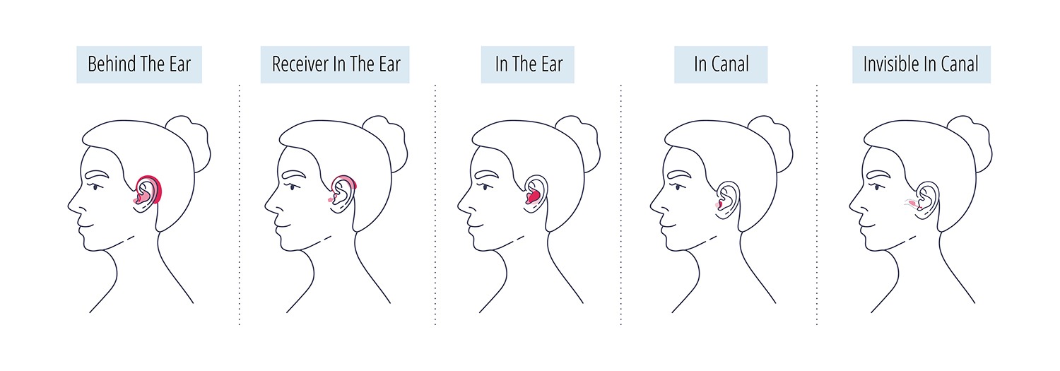 Types of Hearing Aids | Auditorey